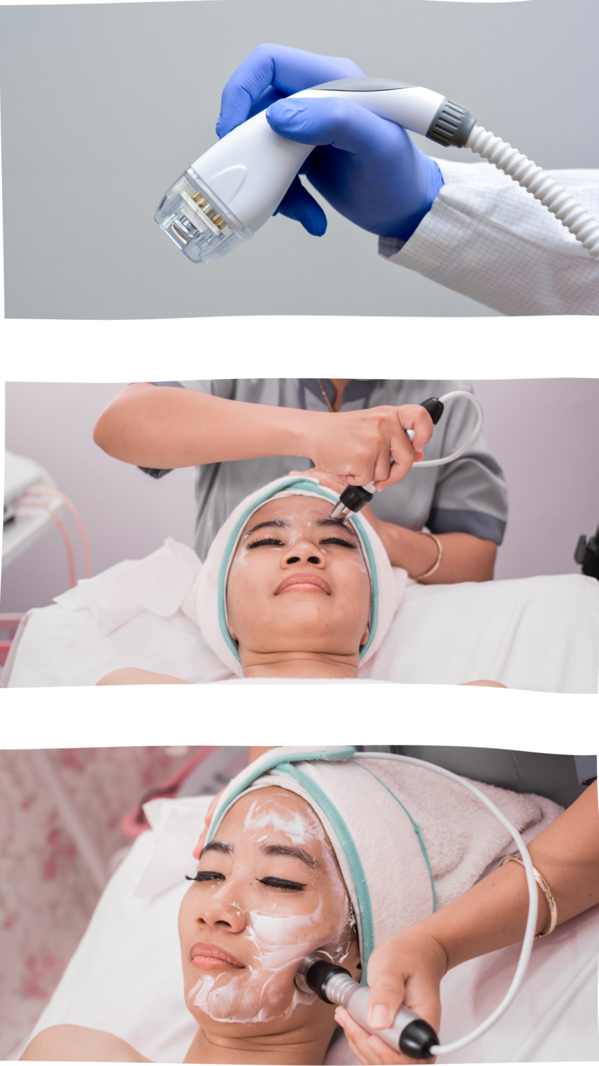 Non-Surgical Revolution - JUST ABOUT FACES